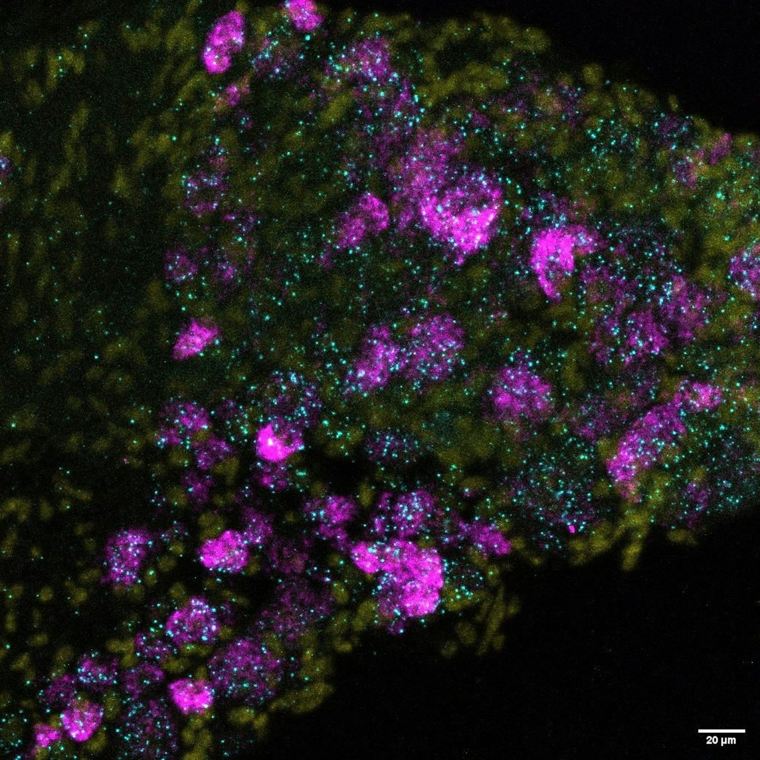 The Importance of a 'Gentle Touch' Molecule for Light Tactile Sensation ...